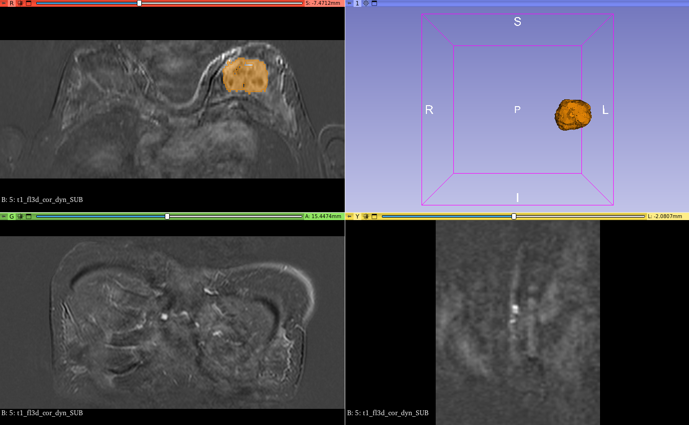 What Is DICOM? Understanding the Standard Powering Modern Medical Imaging